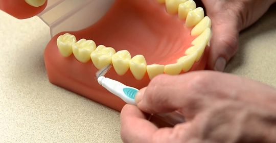 Cepillos interdentales en la higiene oral - Amora Clínica Dental